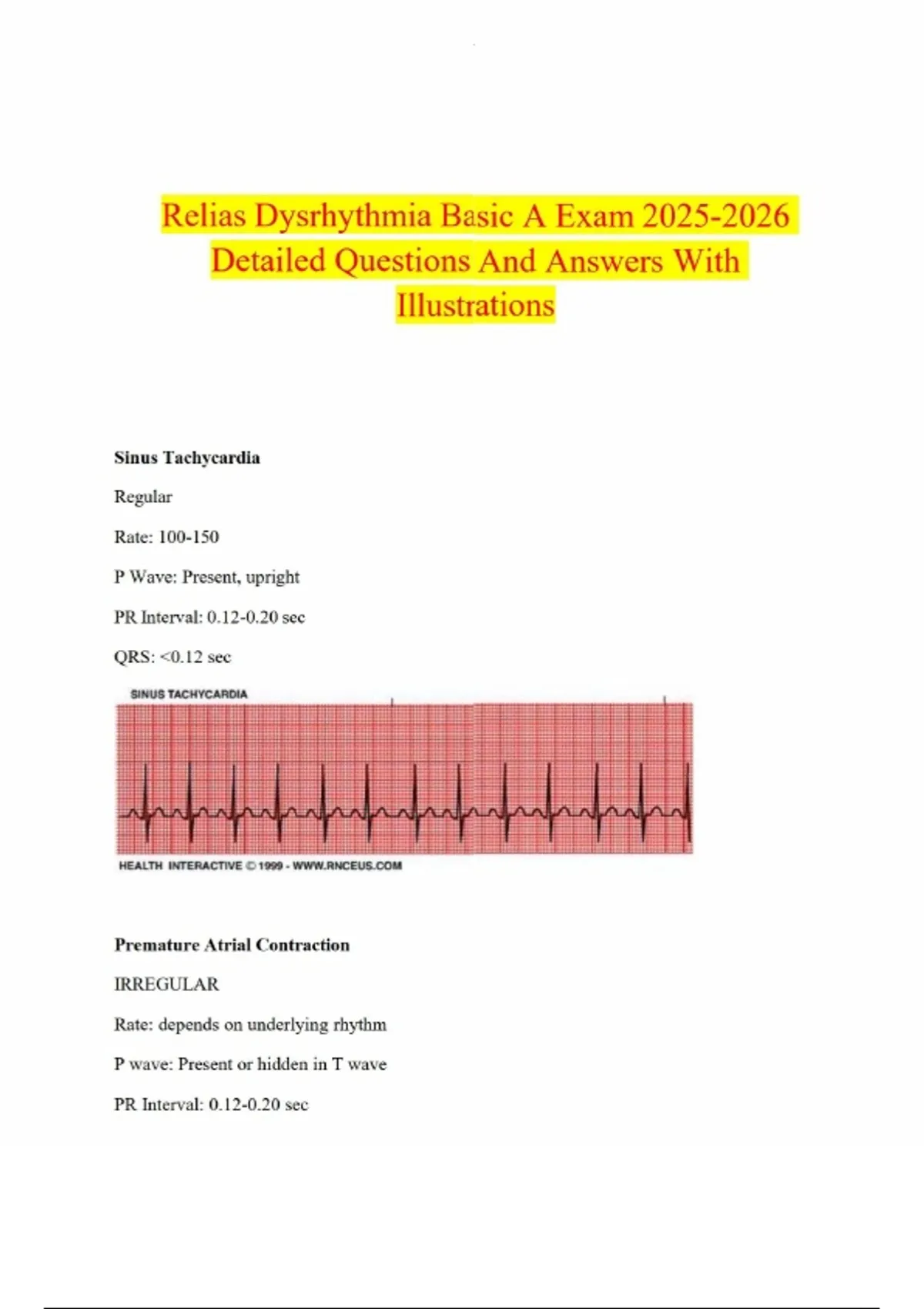 Relias Dysrhythmia Basic A Exam Detailed questions And Answers with ...