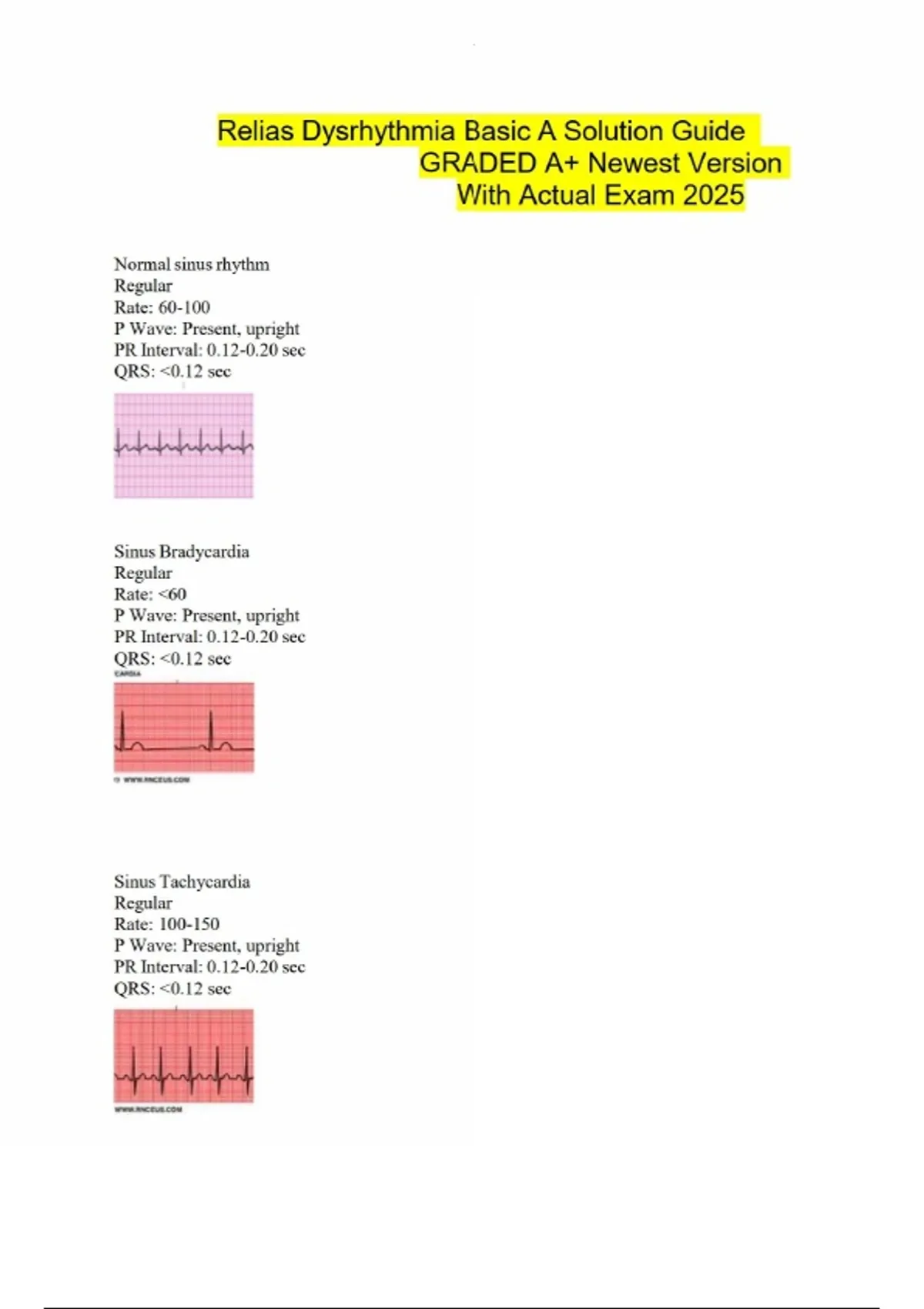Relias Dysrhythmia Basic A Solution Guide GRADED A+ Newest Version With ...
