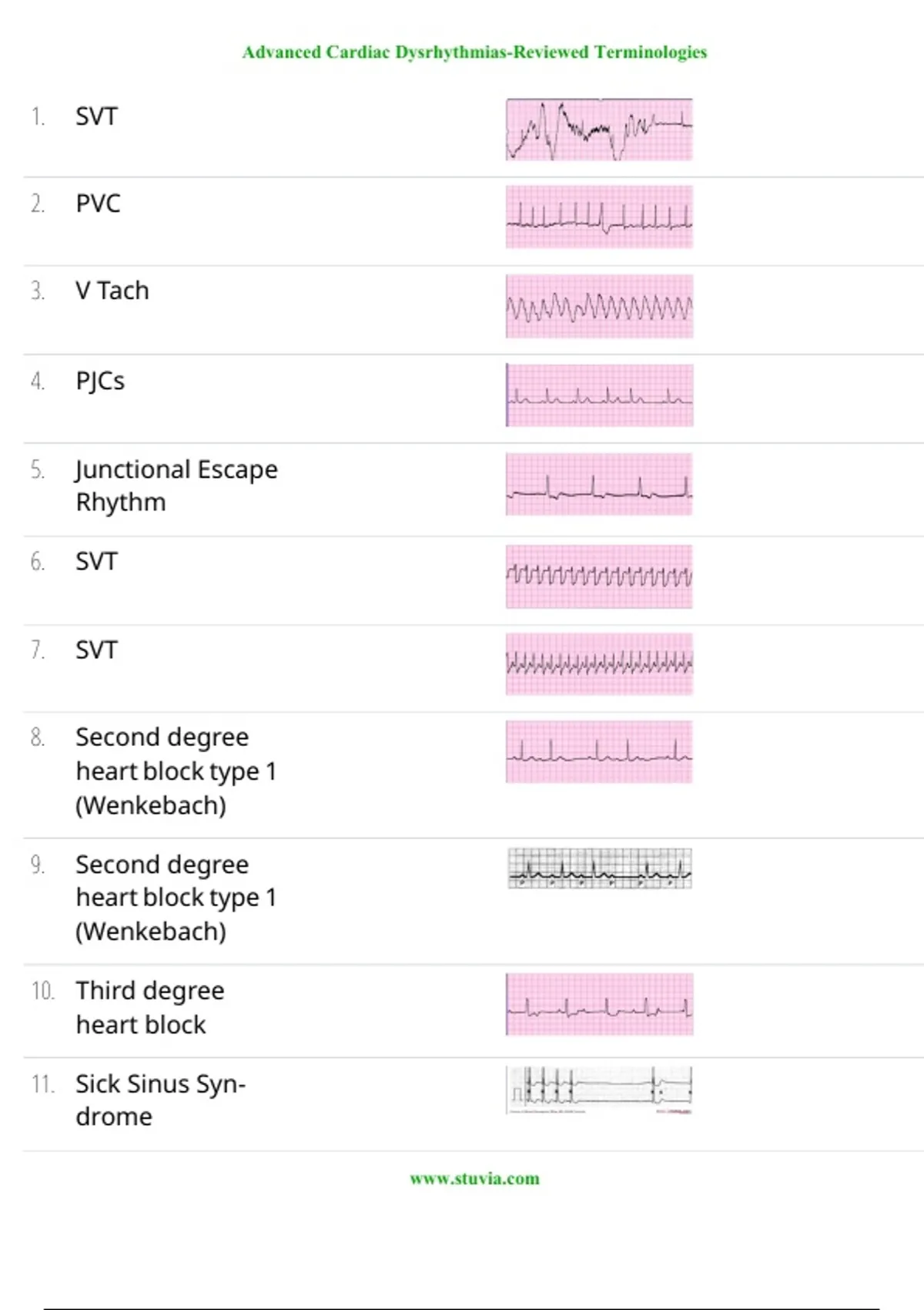 Advanced Cardiac Dysrhythmias Reviewed Terminologies | 2025 Verified ...
