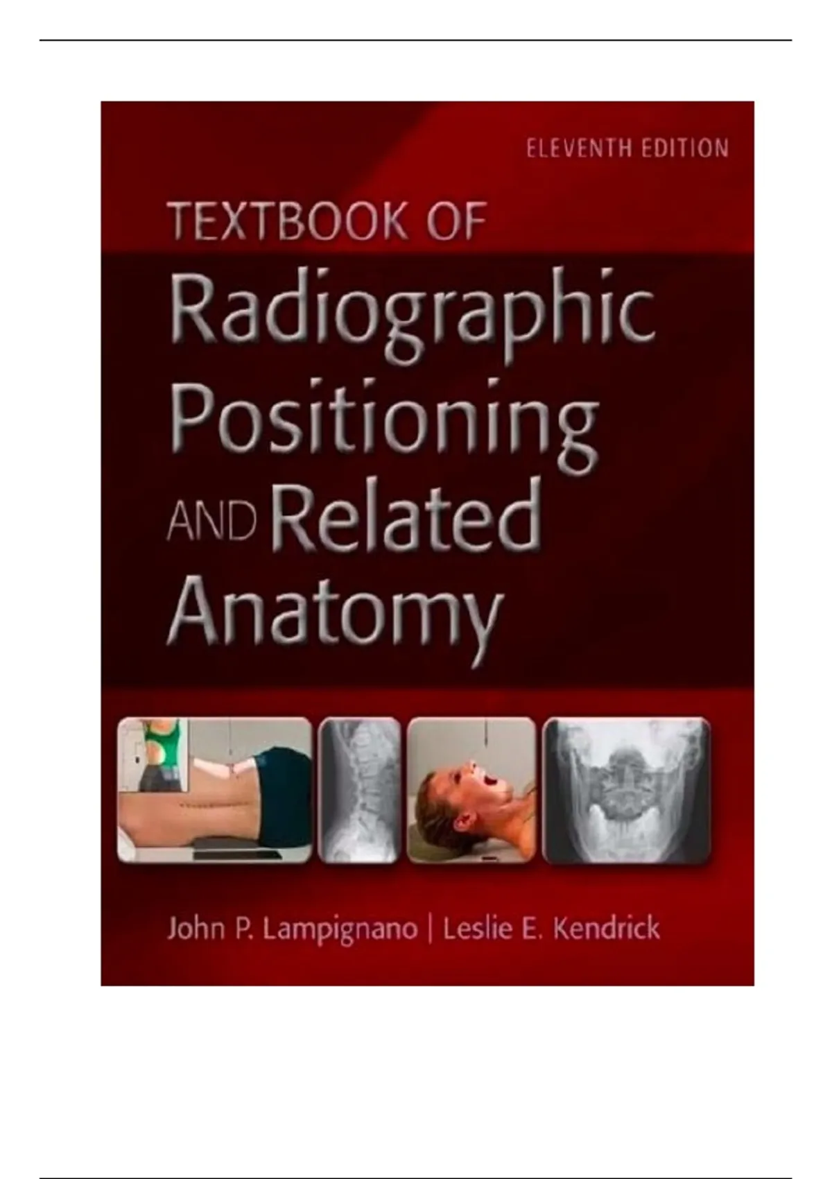 Test Bank for Radiographic Positioning and Related Anatomy 11th Edition ...