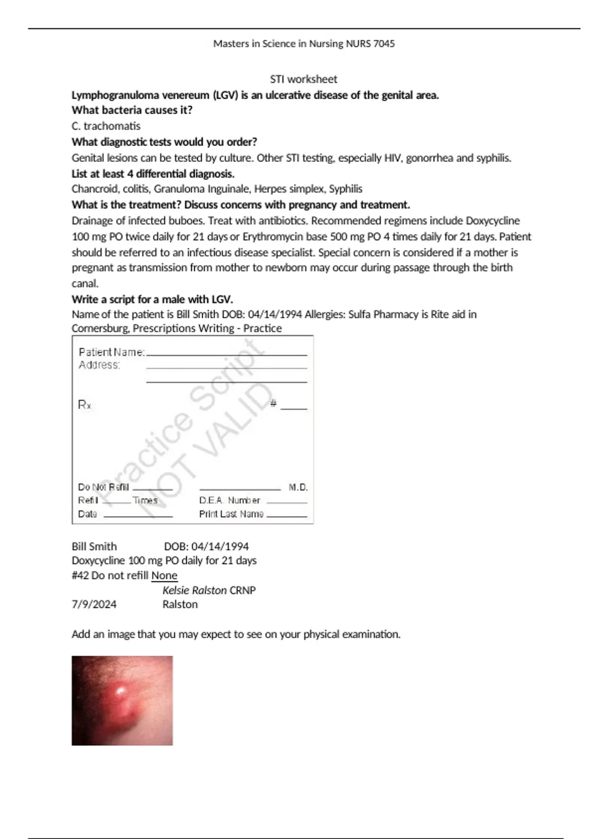 Masters in Science in Nursing NURS 7045 STI worksheet | NURS7045 STI ...