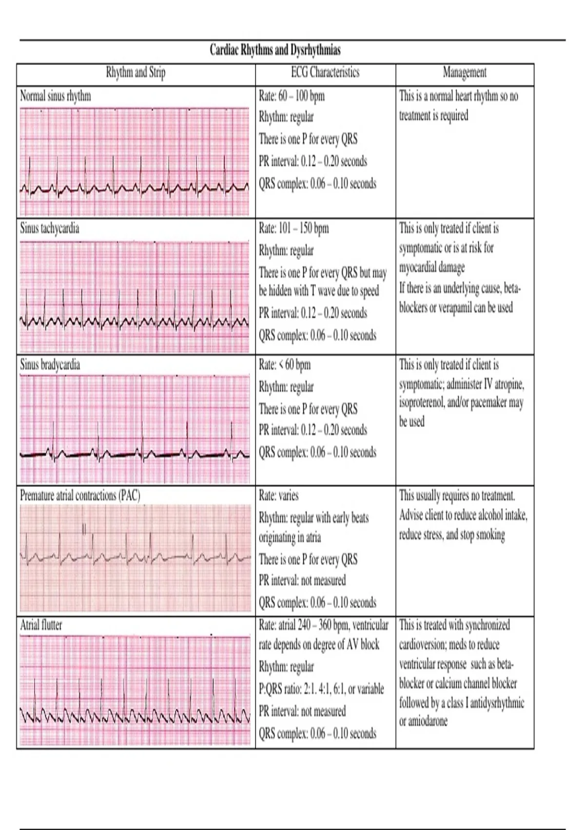 13 cardiac rhythm and dysrhythmias cheat sheet any nurse must know for ...