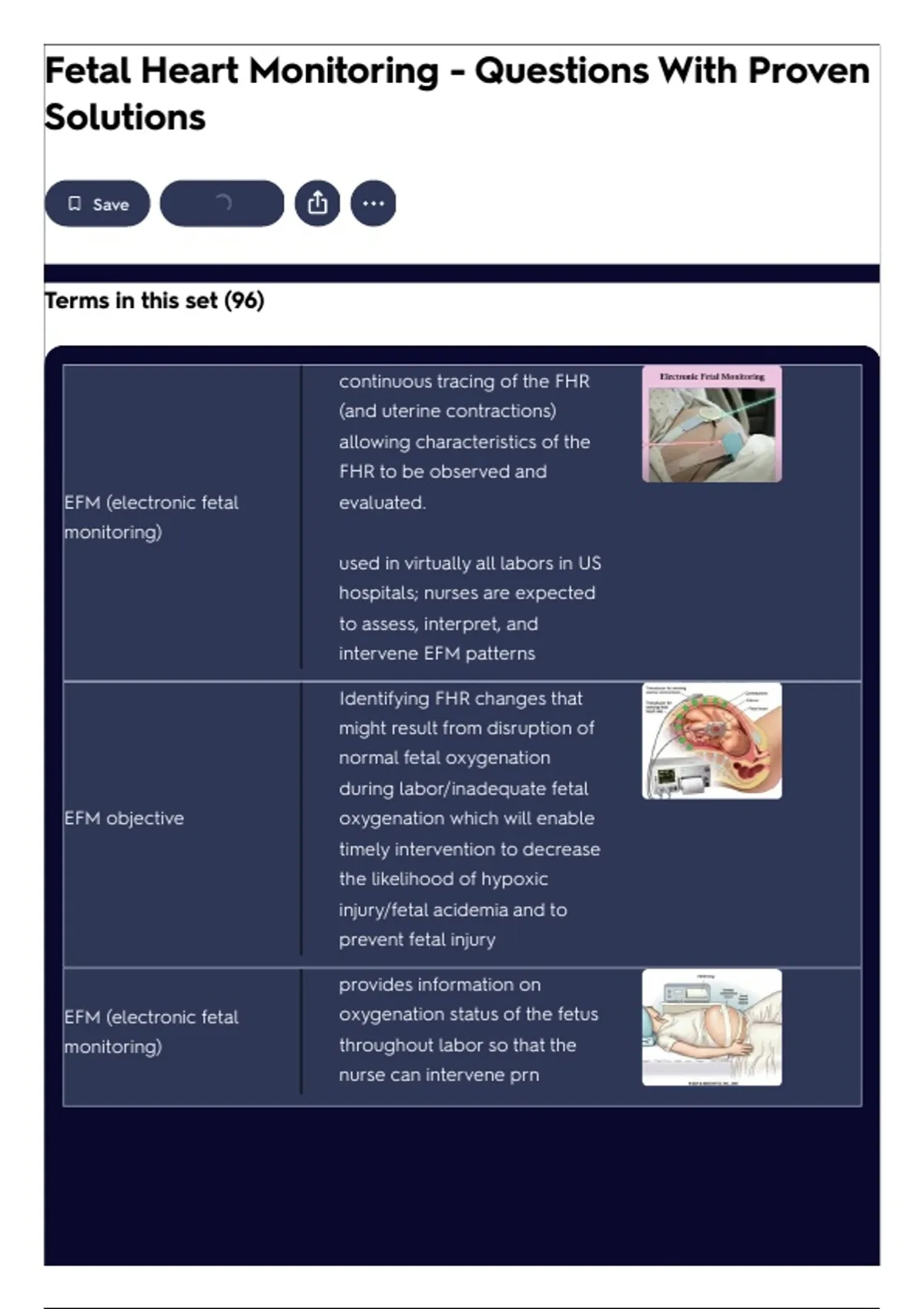 Fetal Heart Monitoring - Questions With Proven Solutions - FETAL HEART ...