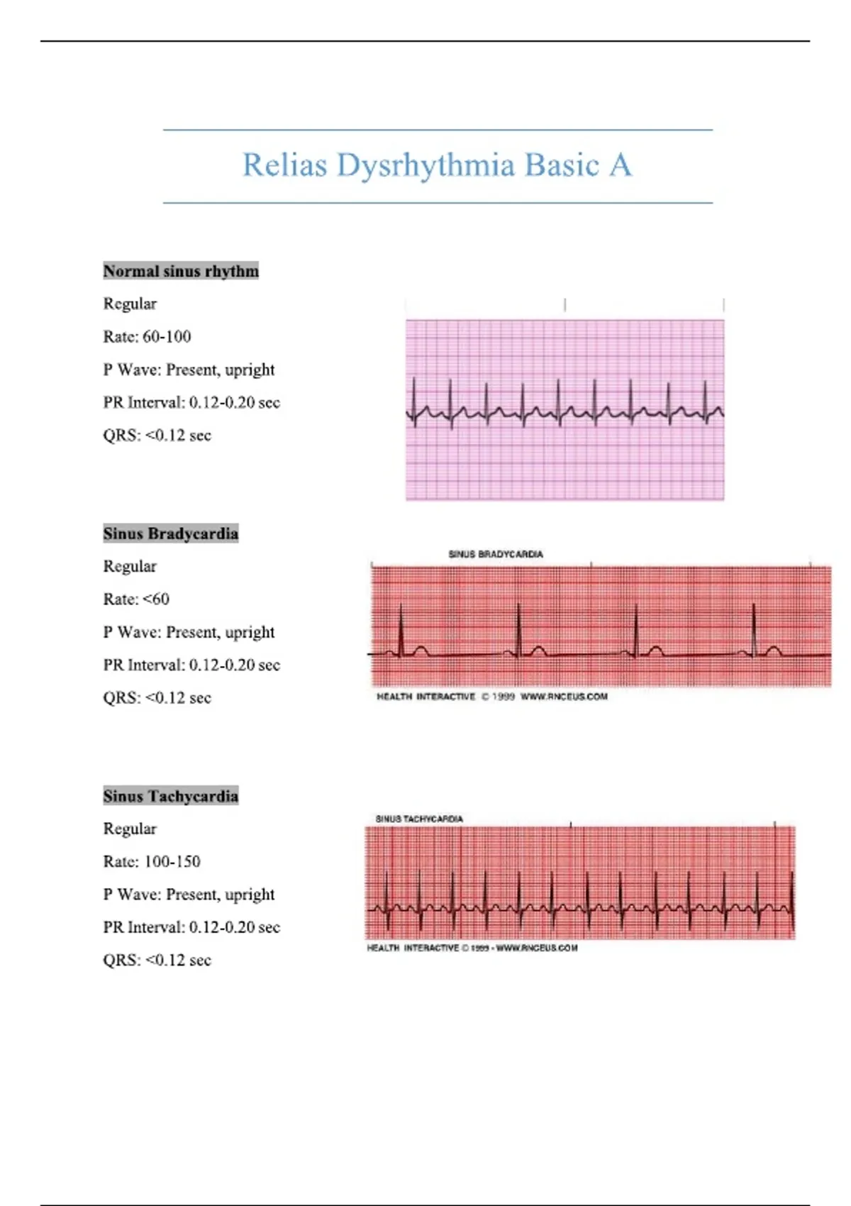 Relias Dysrhythmia Basic A 2025 - Relias dysrhythmia - Stuvia US