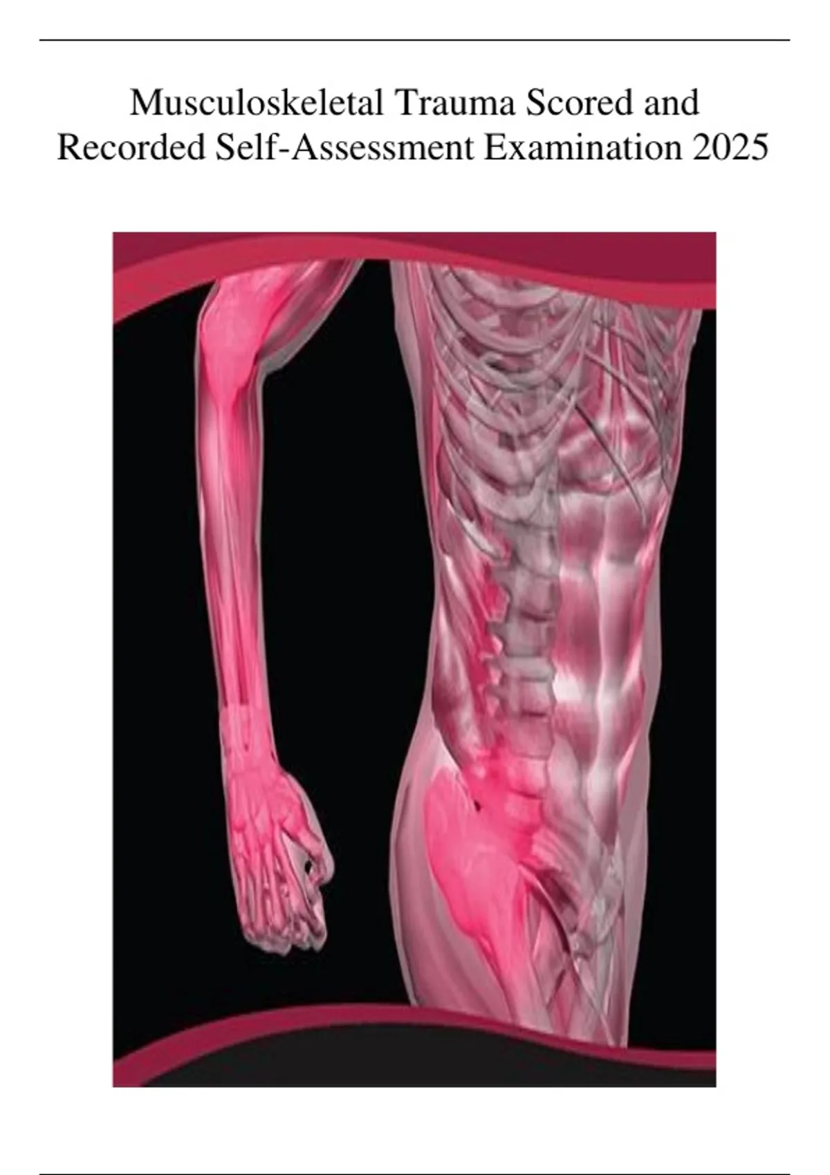 Musculoskeletal Trauma Scored and Recorded Self-Assessment Examination – 2025 Edition | Verified ...