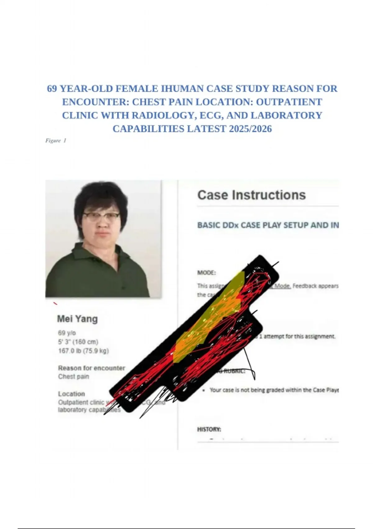 69-Year-Old Female – Human Case Study: Chest Pain in an Outpatient ...