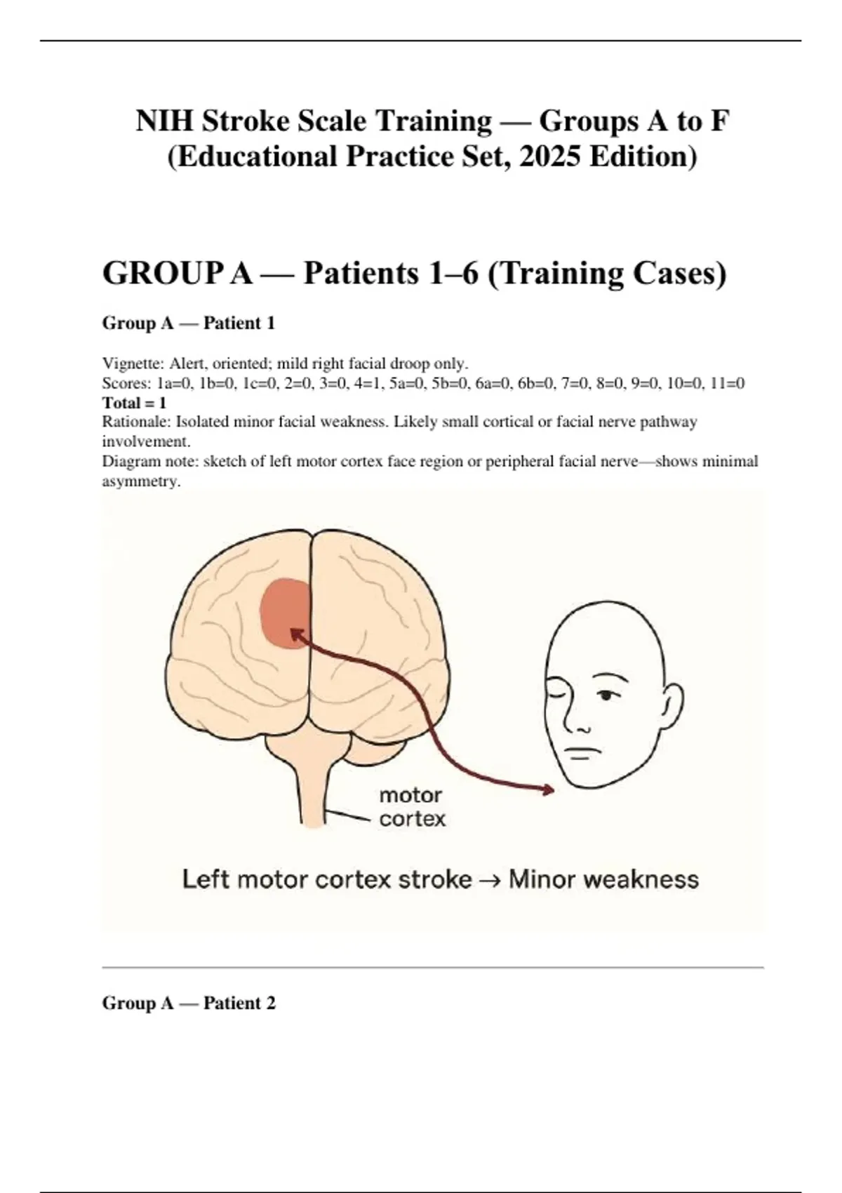 The NIH Stroke Scale (NIHSS) Training – Groups A to F (2025 Edition) is ...