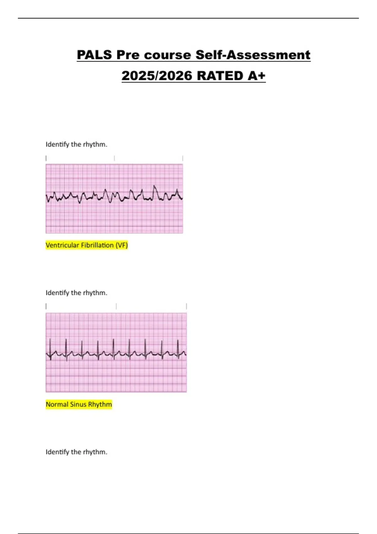 PALS Pre-Course Self-Assessment 2025/2026 – Complete Questions and ...