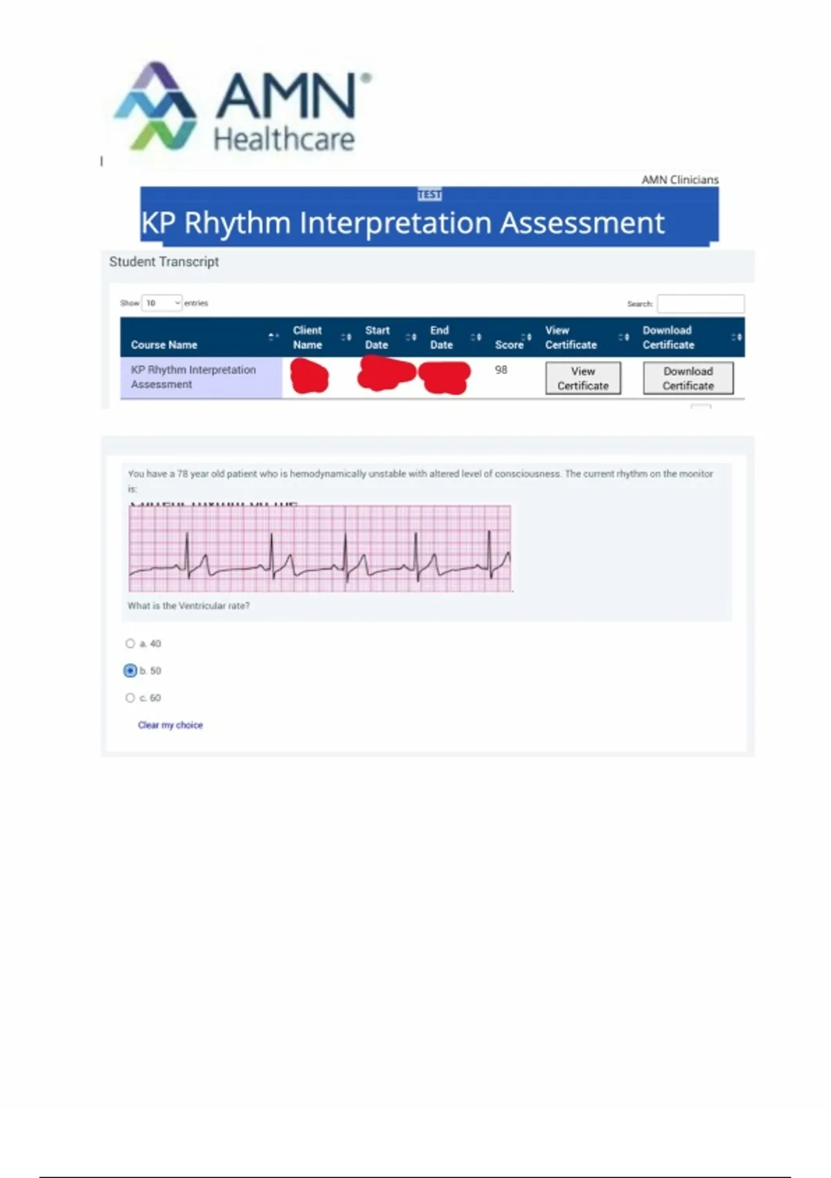 EKG Rhythm interpretation assessment : AMN Healthcare: KP Rhythm interpretation (50 questions ...