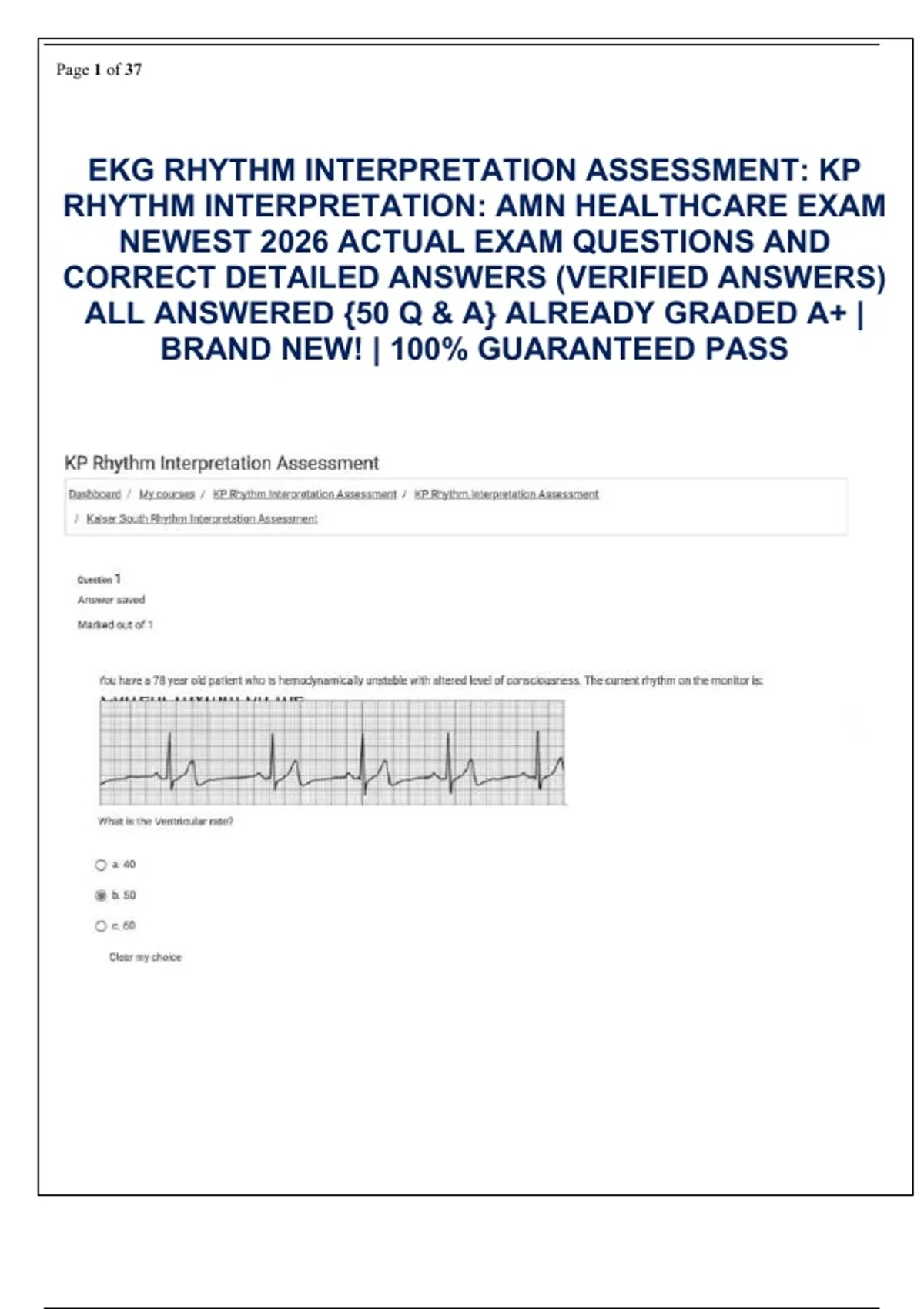 EKG RHYTHM INTERPRETATION ASSESSMENT: KP RHYTHM INTERPRETATION: AMN ...