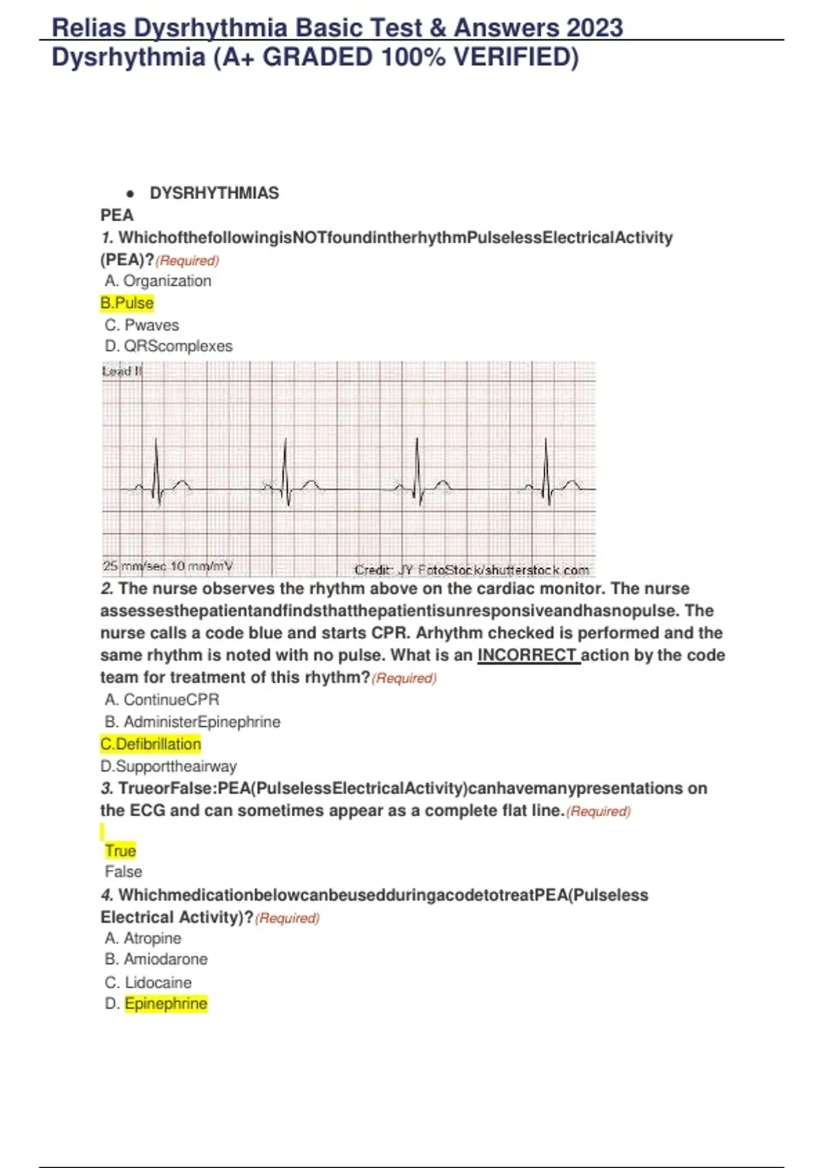 Relias Dysrhythmia Basic Test & Answers 2023 Dysrhythmia (A+ GRADED 100 ...